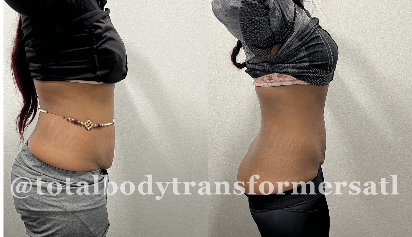 Total Body Transformers | Weight Maps